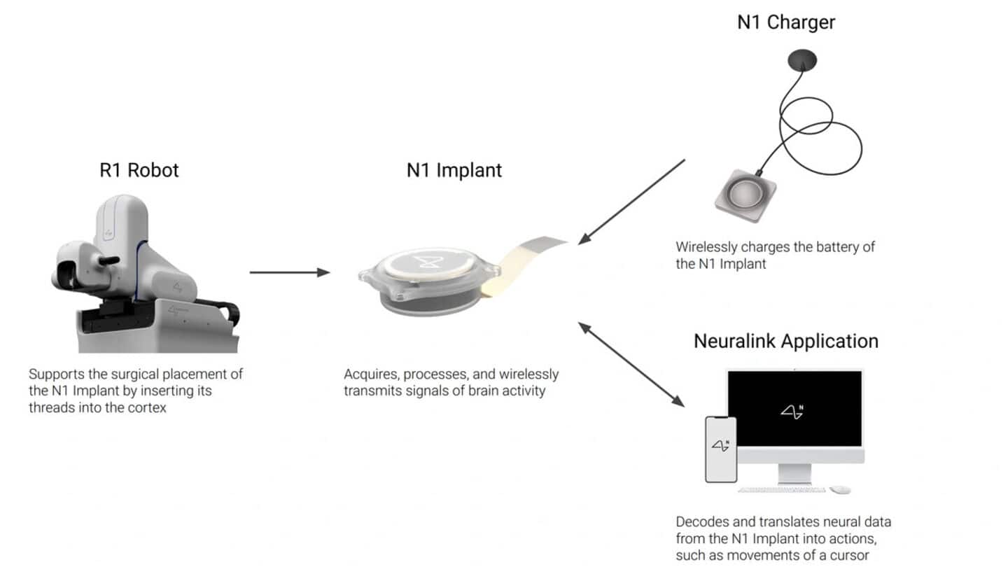 Northwestern University unveils 'Neuro-Key' implant to restore lost senses