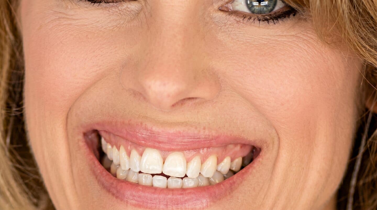 Japanese researchers begin human trials for drug to regrow teeth