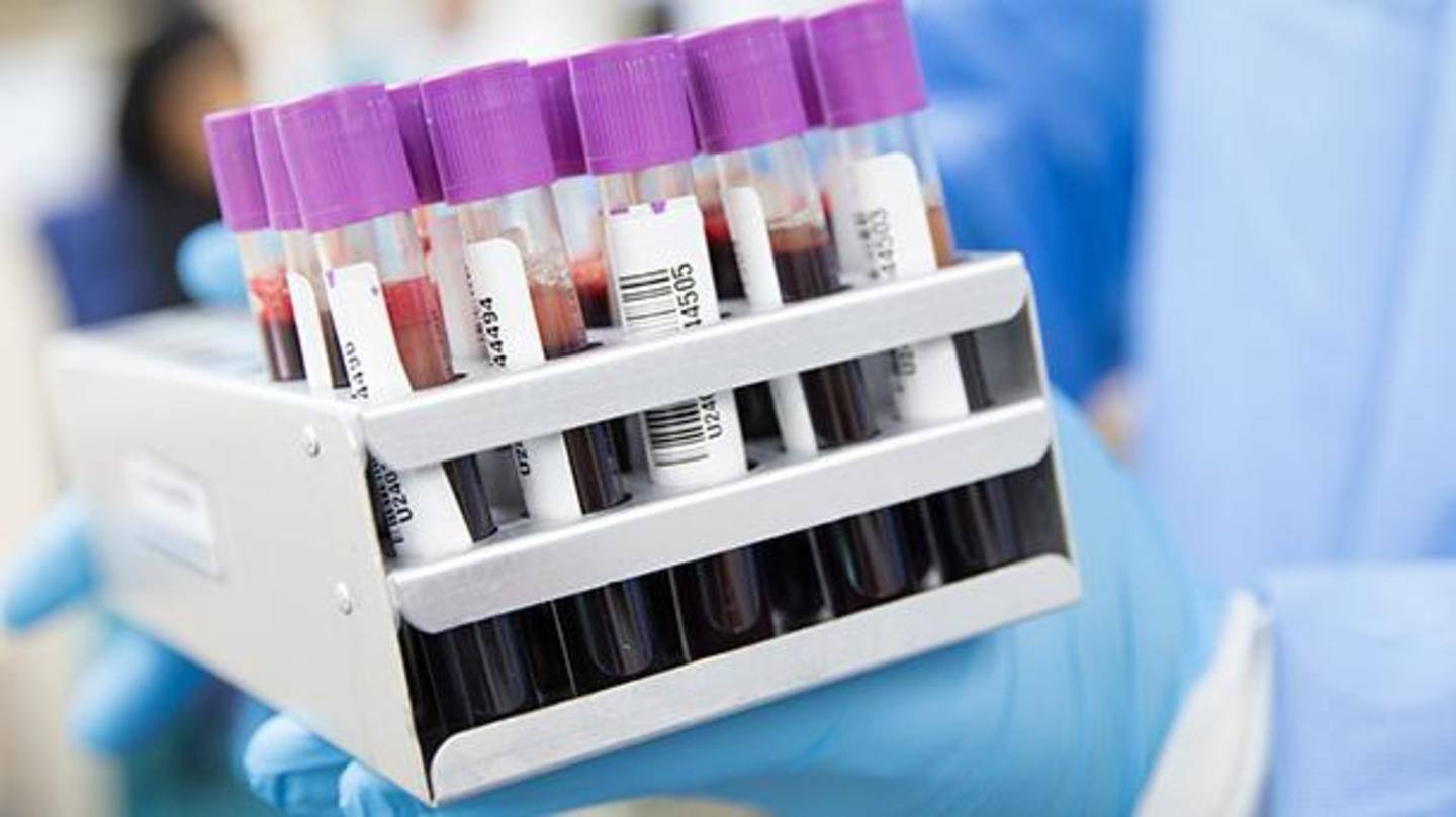 Delhi plans to begin random serological tests starting June 27 | NewsBytes