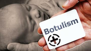 Infant botulism: Everything you need to know